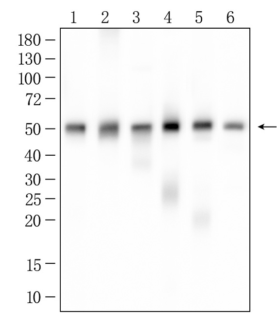 Recombinant β III tubulin Rabbit Monoclonal Antibody - 一品众合官网