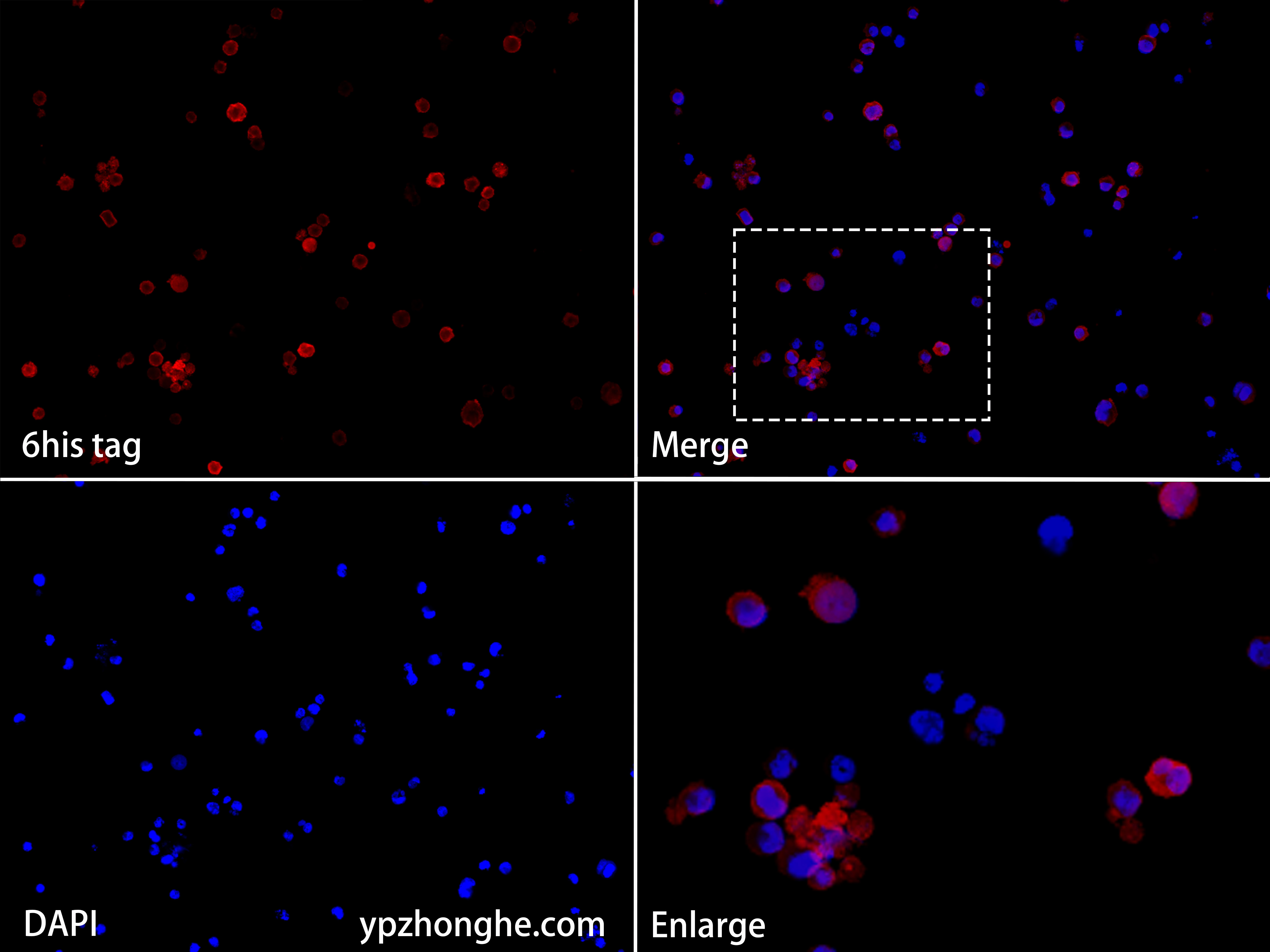 6X His tag Recombinant Rabbit Monoclonal Antibody(C-terminal,N-terminal ...
