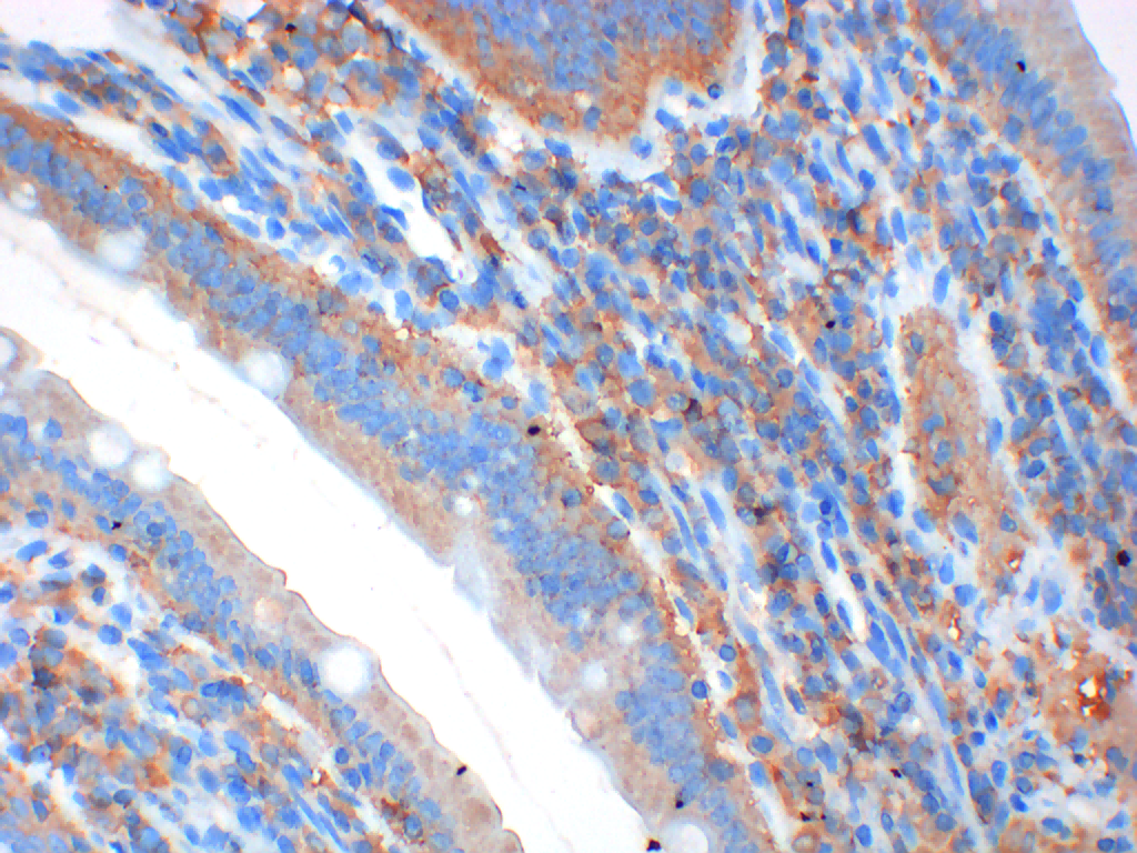 Recombinant SQSTM1/p62 Mouse Monoclonal Antibody - 一品众合官网