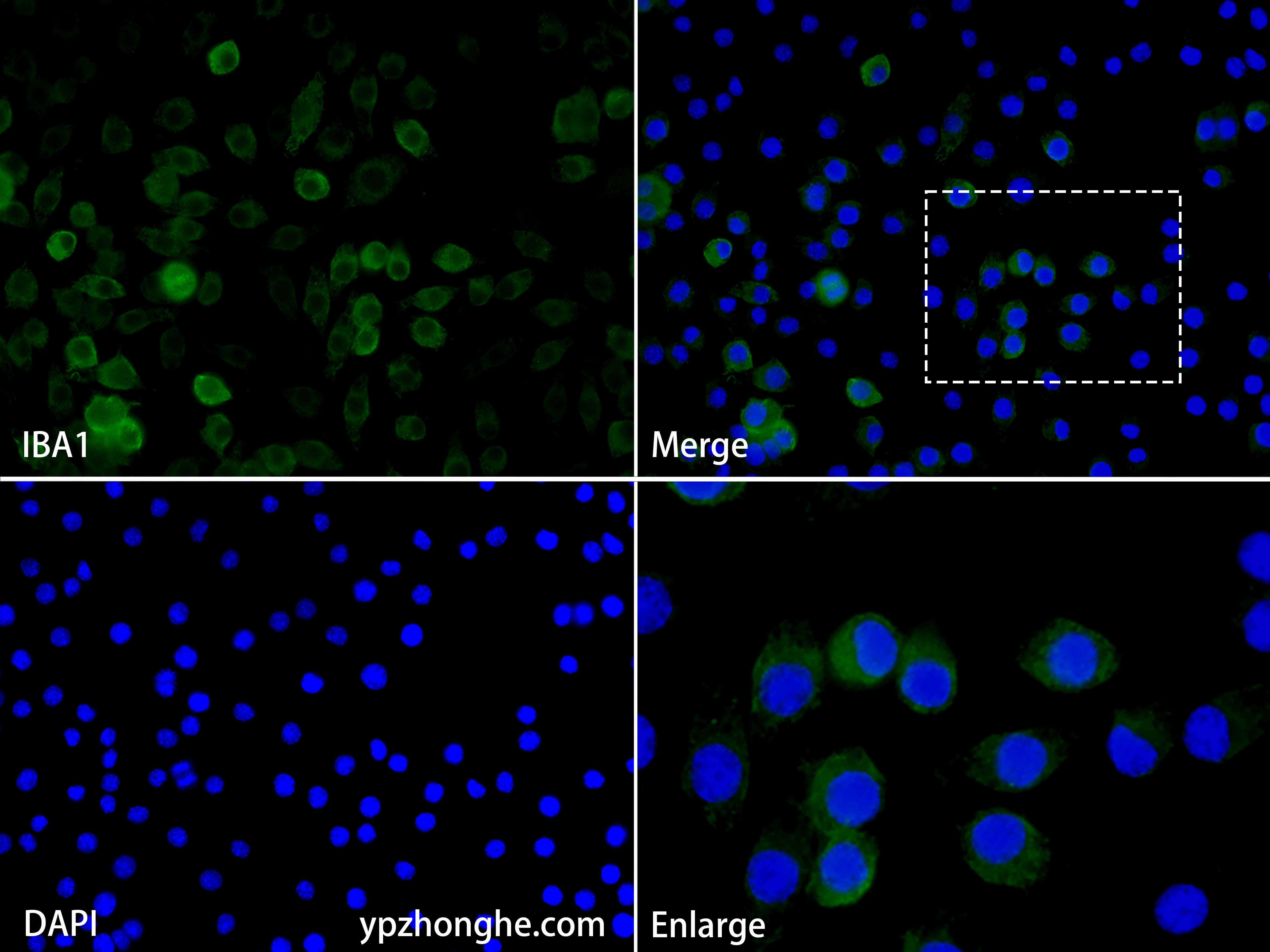 Iba1 Recombinant Rabbit Monoclonal Antibody - 一品众合官网