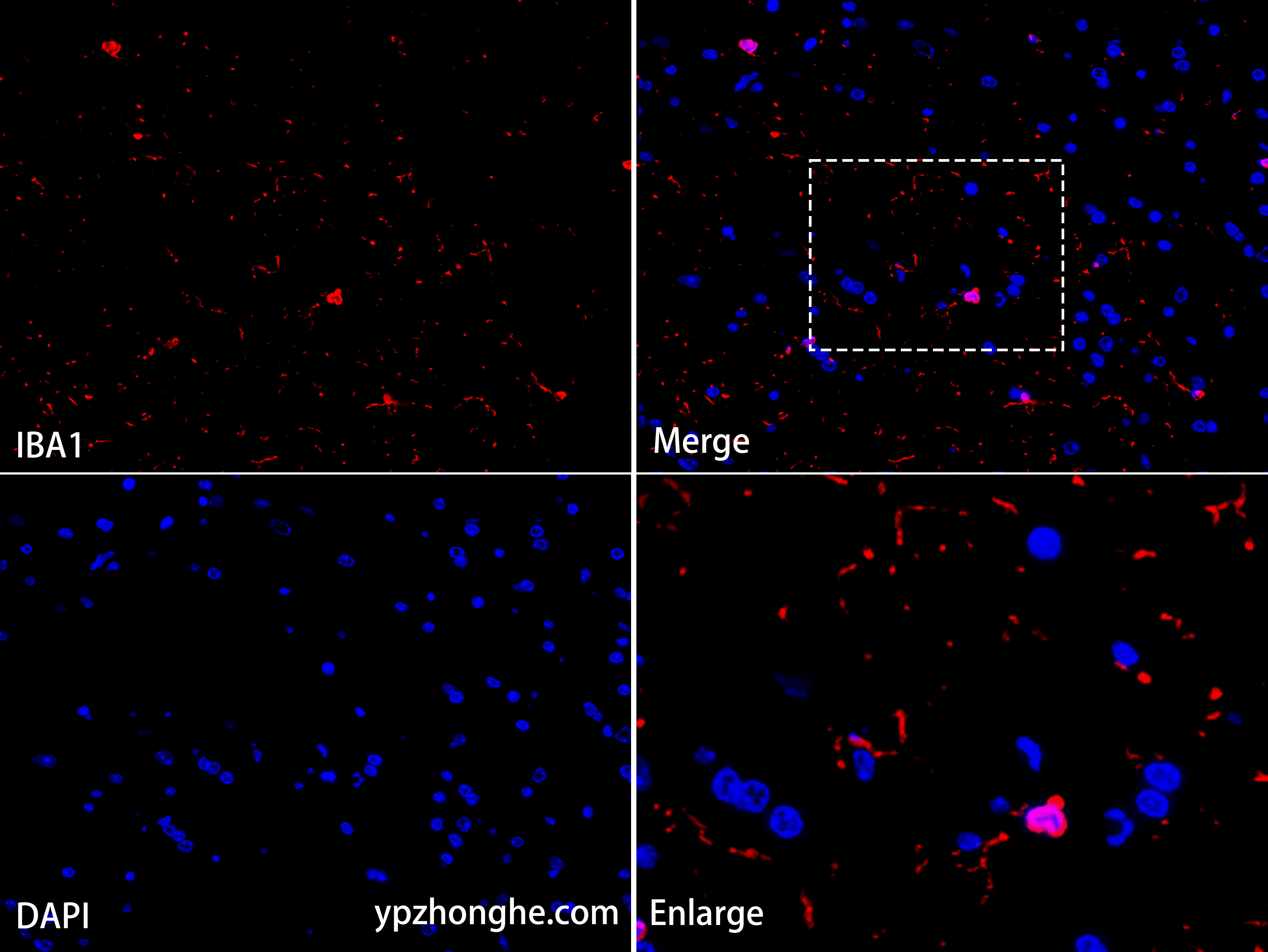 Iba1 Recombinant Rabbit Monoclonal Antibody - 一品众合官网
