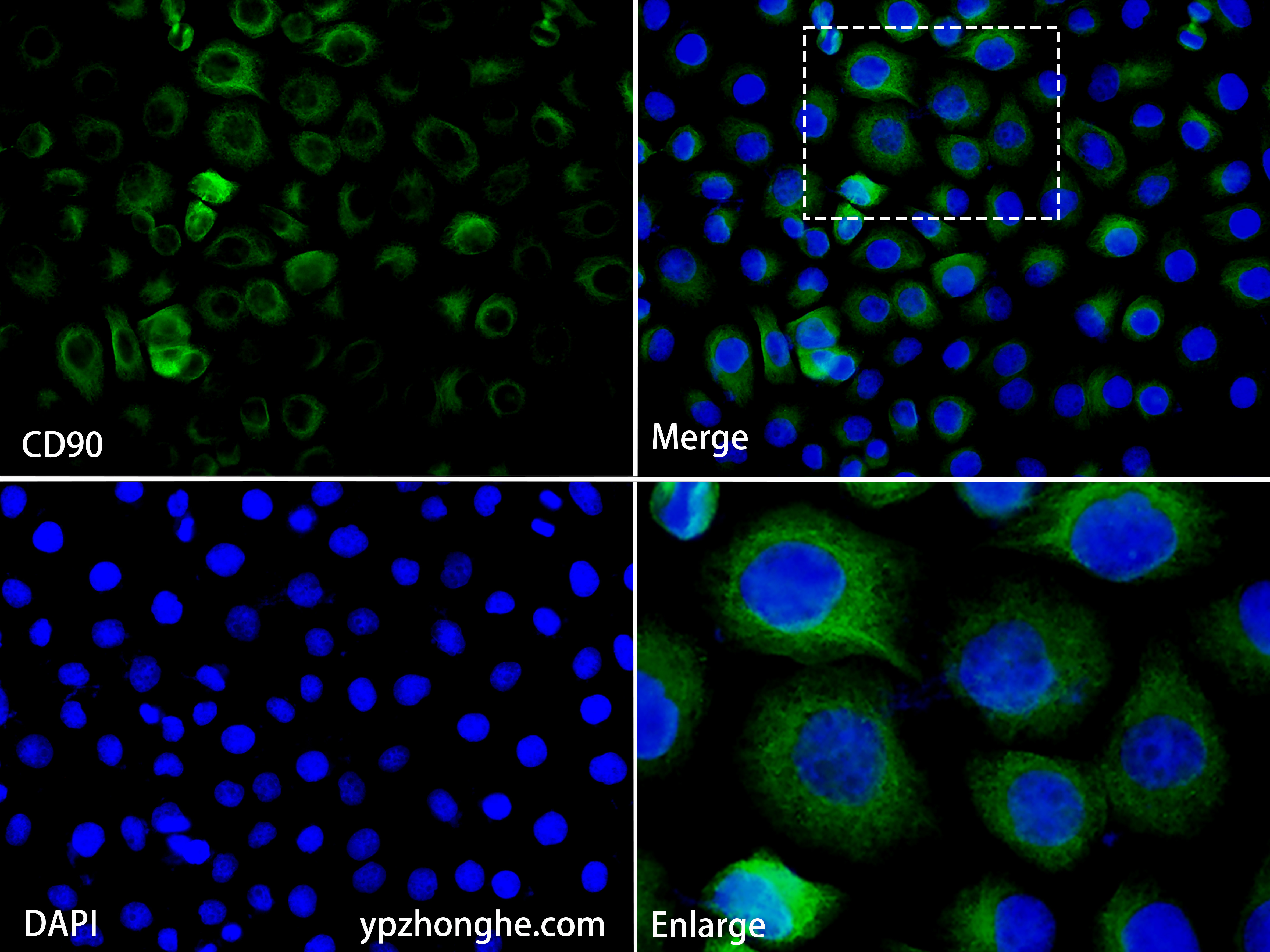 CD90 Recombinant Rabbit Monoclonal Antibody - 一品众合官网