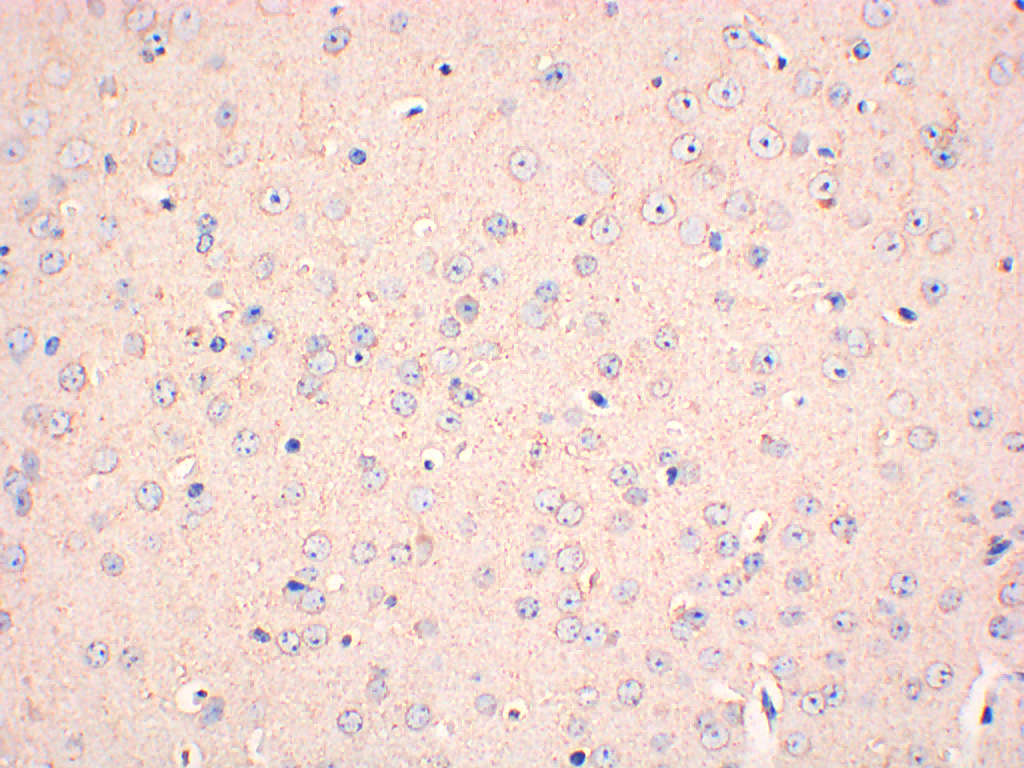 CD90 Recombinant Rabbit Monoclonal Antibody - 一品众合官网