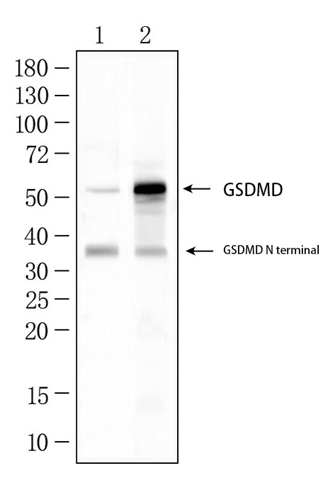 Recombinant GSDMD N-terminal/Overall length Rabbit Monoclonal Antibody ...
