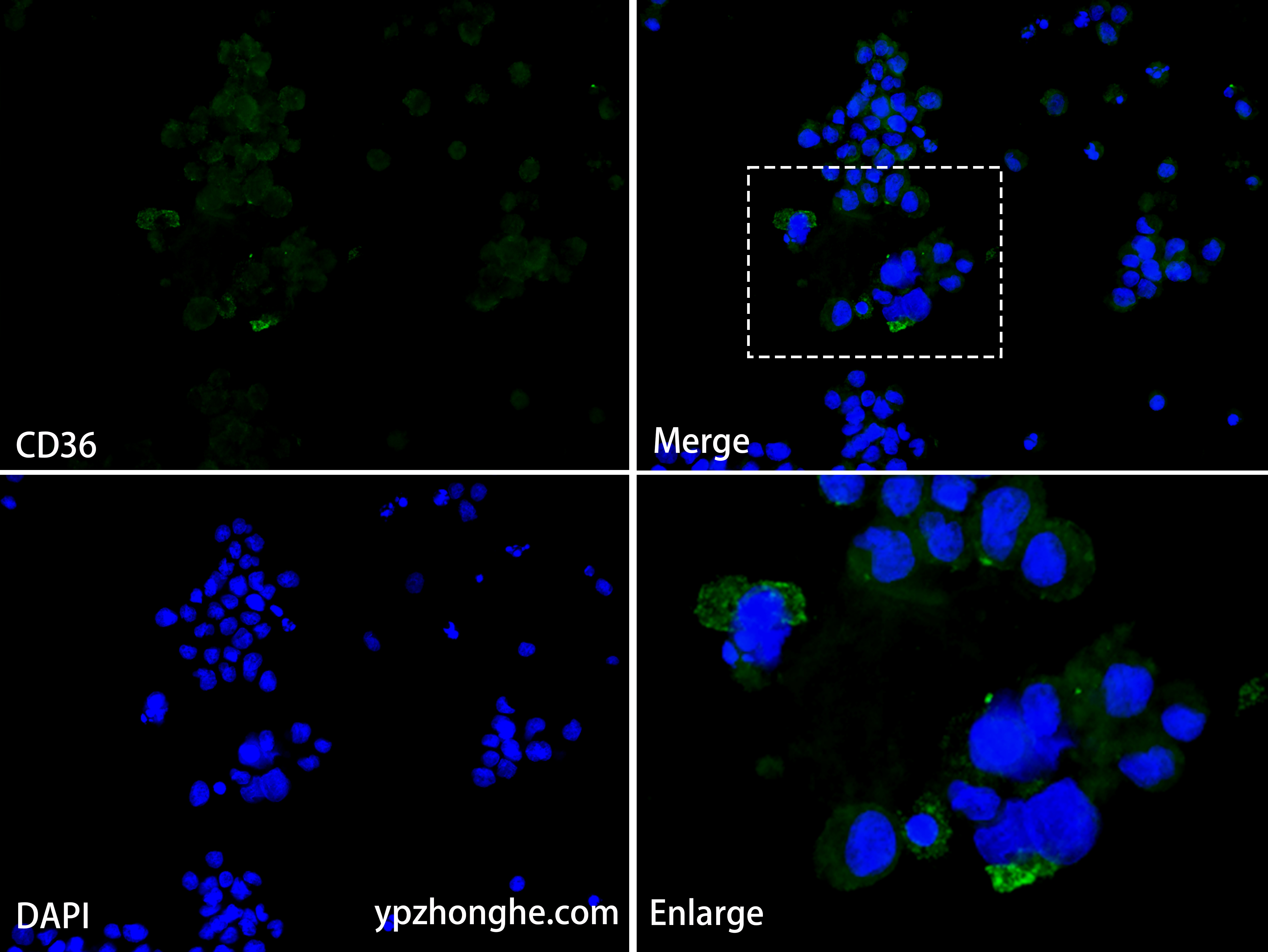 Recombinant CD36 Rabbit Monoclonal antibody - 一品众合官网