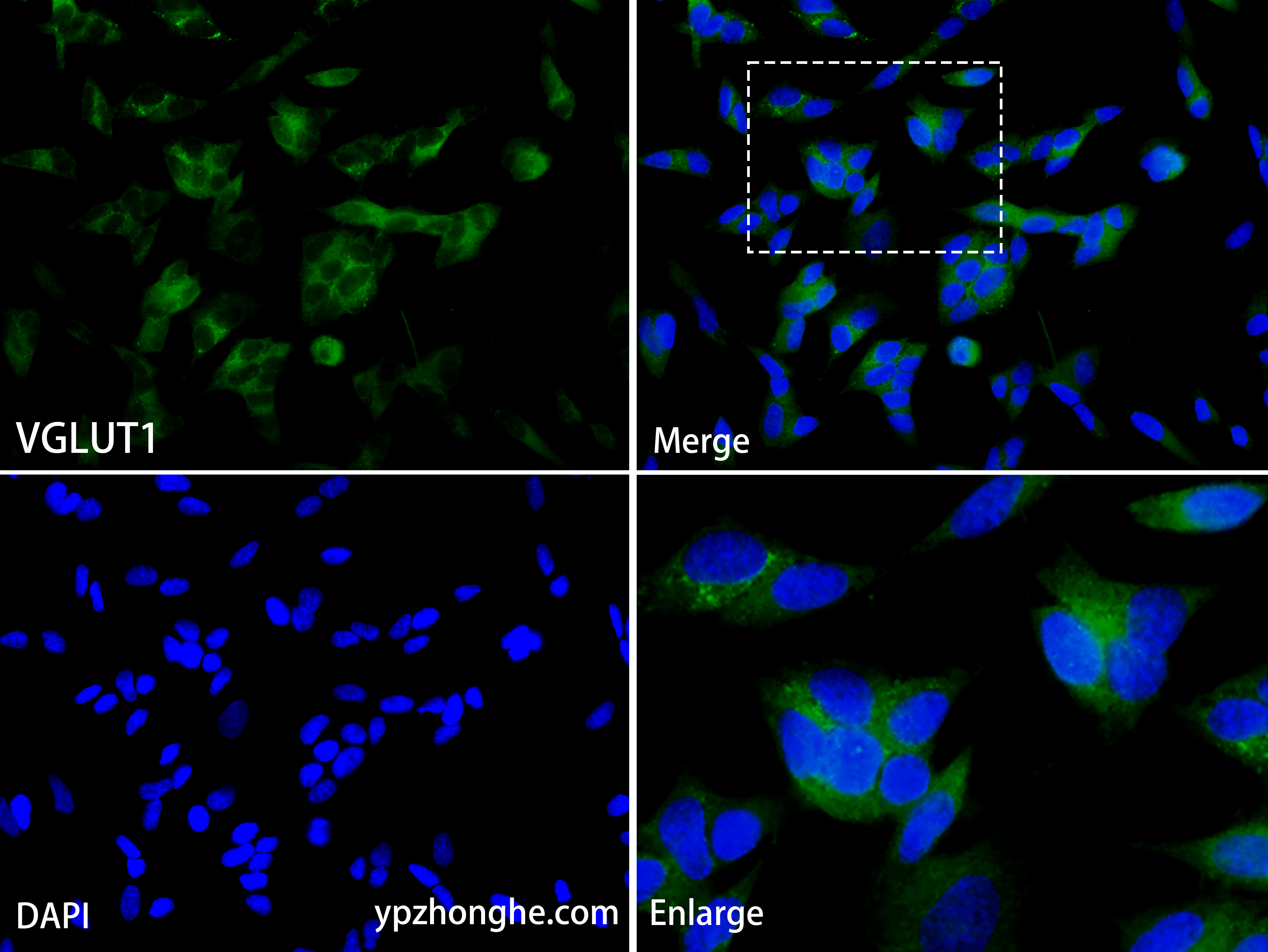 Recombinant VGLUT1 Rabbit Monoclonal Antibody - 一品众合官网