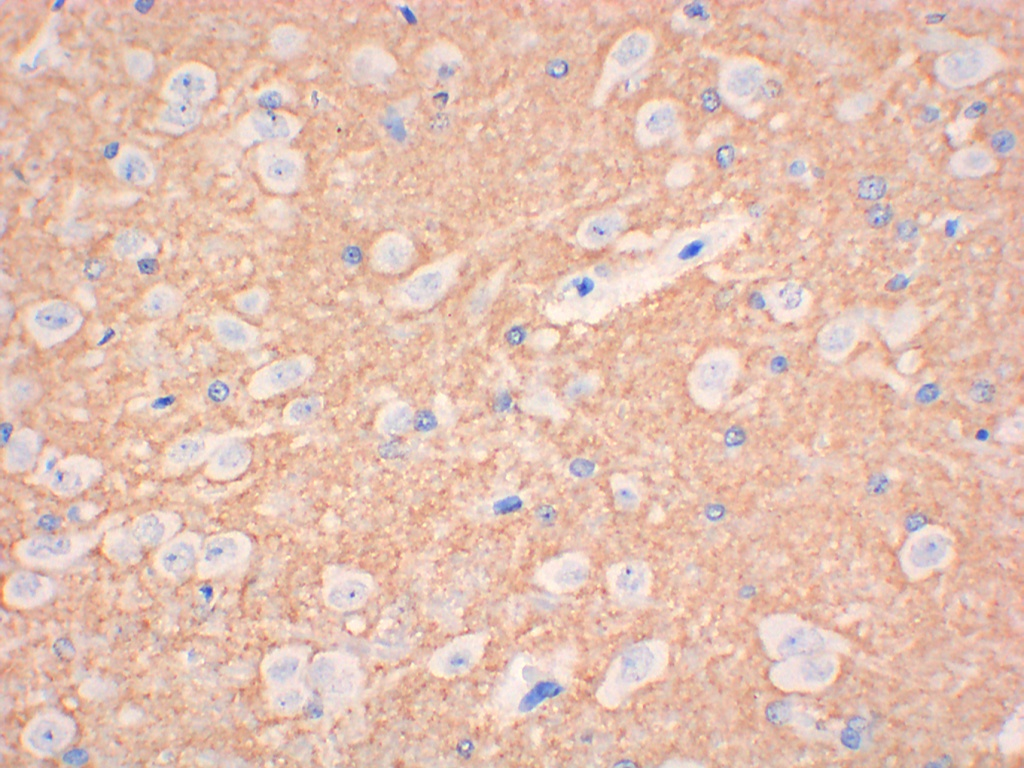 Recombinant VGLUT1 Rabbit Monoclonal Antibody - 一品众合官网