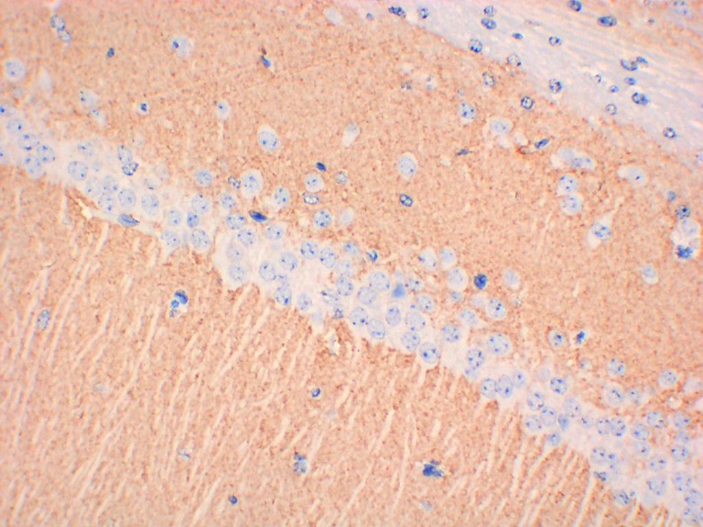 Recombinant VGLUT1 Rabbit Monoclonal Antibody - 一品众合官网
