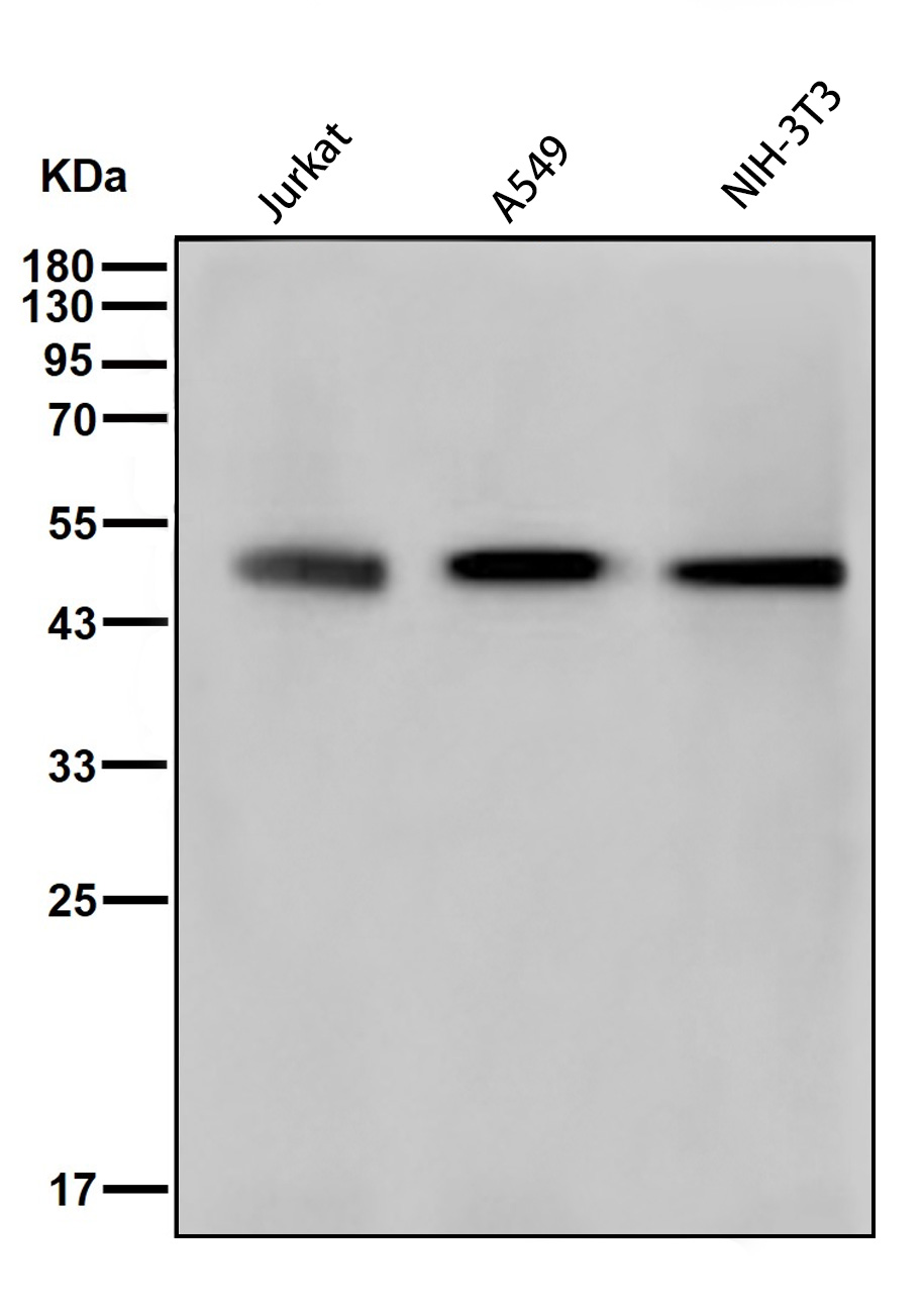 Recombinant Vimentin Rabbit Monoclonal Antibody - 一品众合官网