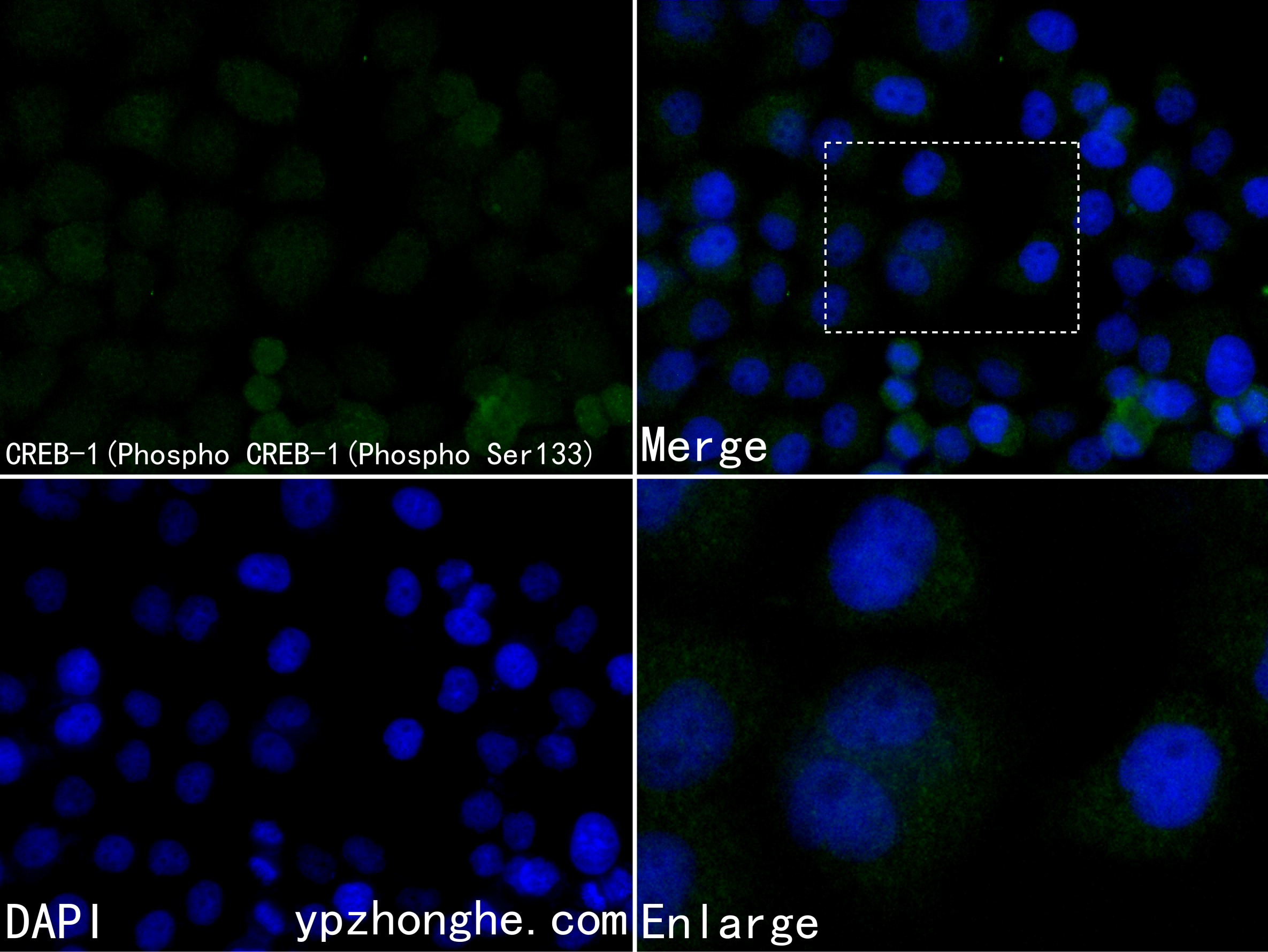 Recombinant CREB-1(Phospho Ser133) Rabbit Monoclonal Antibody - 一品众合官网