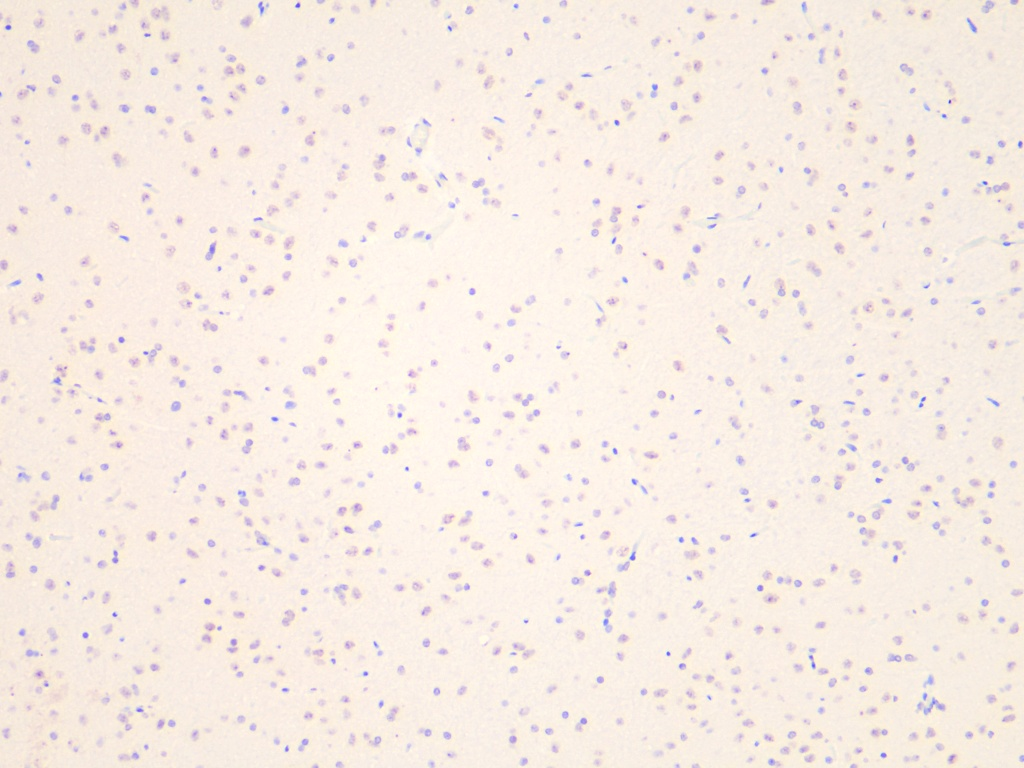 Recombinant CREB-1(Phospho Ser133) Rabbit Monoclonal Antibody - 一品众合官网
