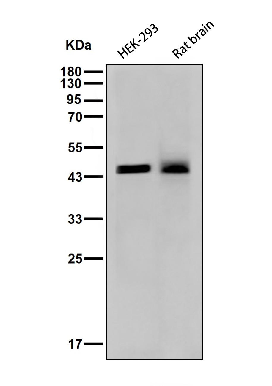 Recombinant CREB-1(Phospho Ser133) Rabbit Monoclonal Antibody - 一品众合官网