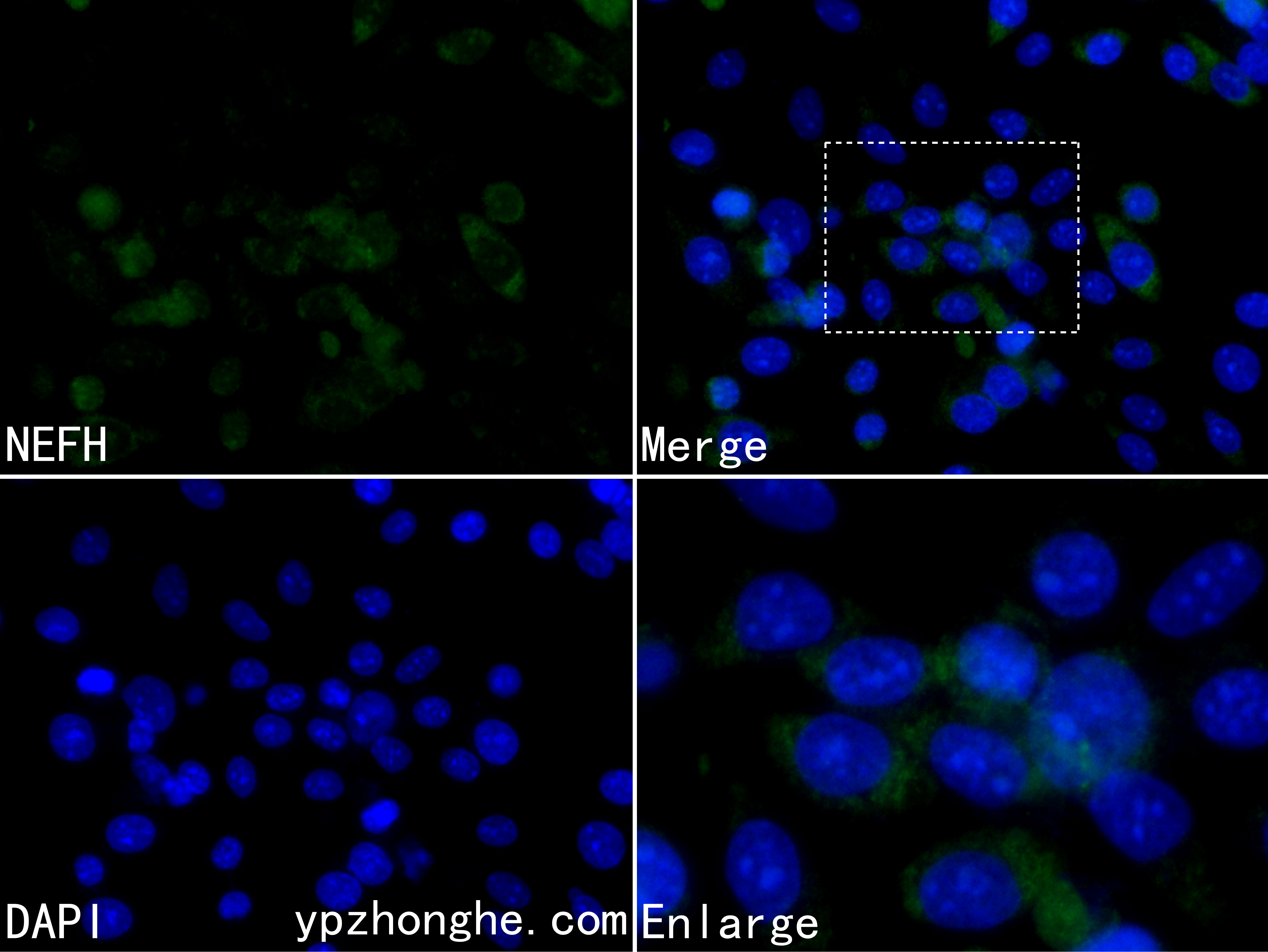 Recombinant NEFH Rabbit Monoclonal Antibody - 一品众合官网