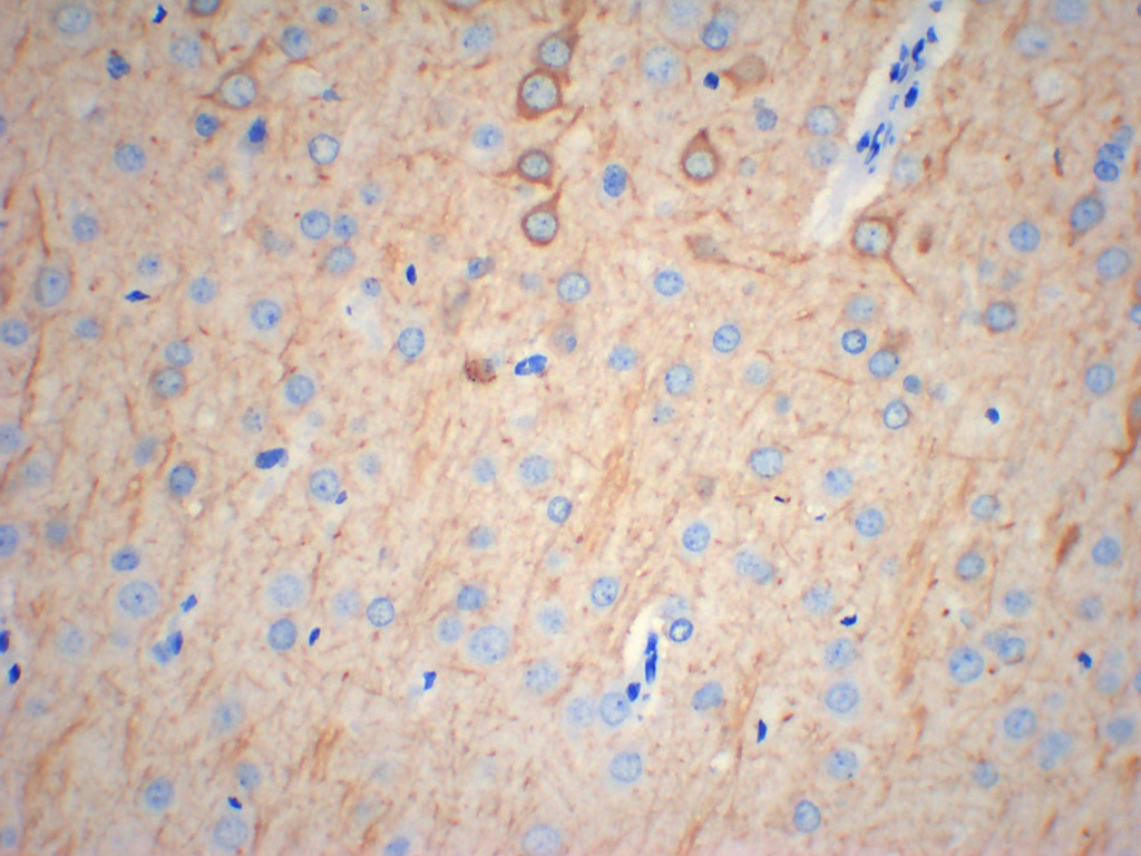 Recombinant NEFH Rabbit Monoclonal Antibody - 一品众合官网