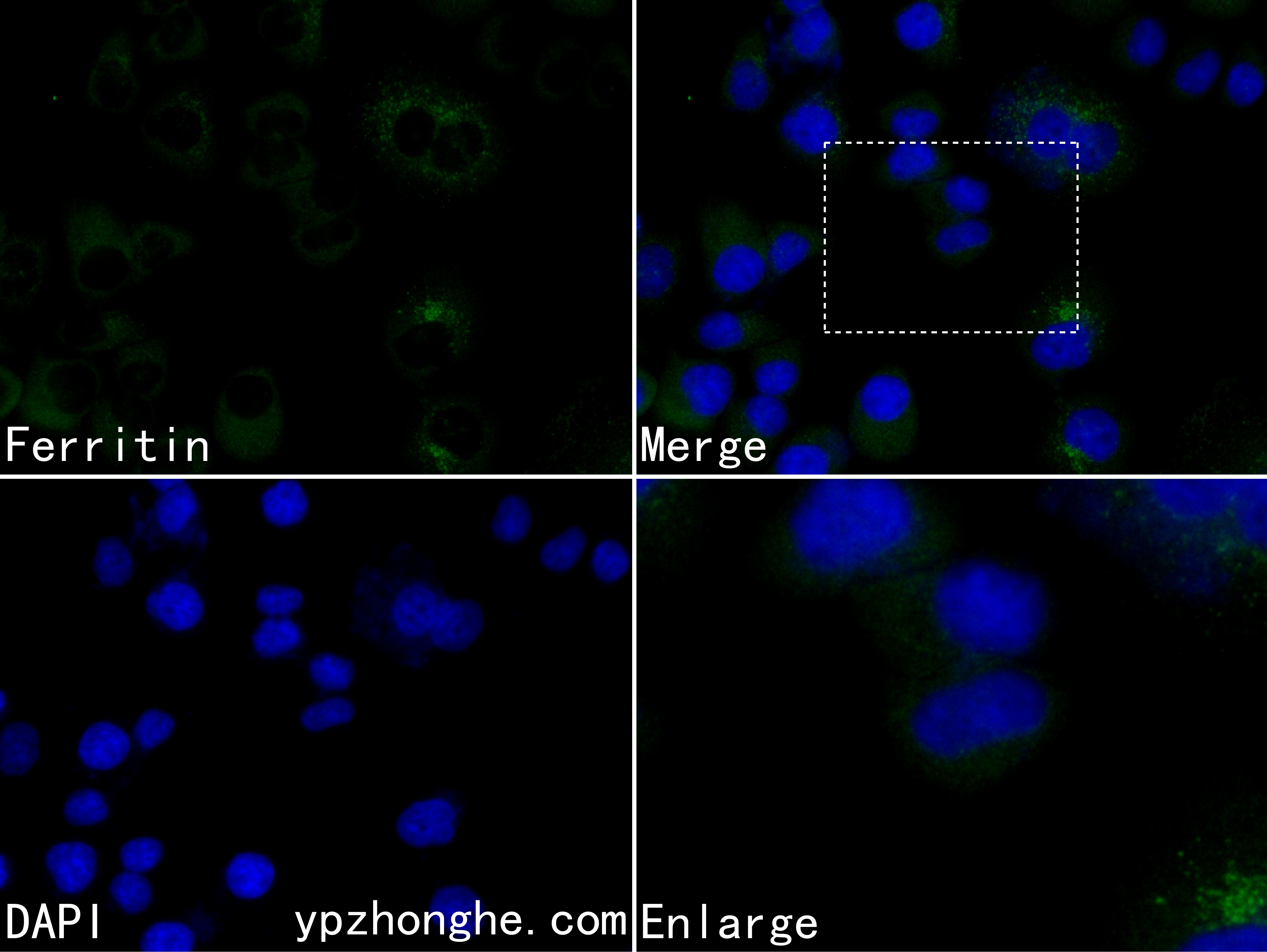 Recombinant Ferritin heavy chain Rabbit Monoclonal Antibody - 一品众合官网