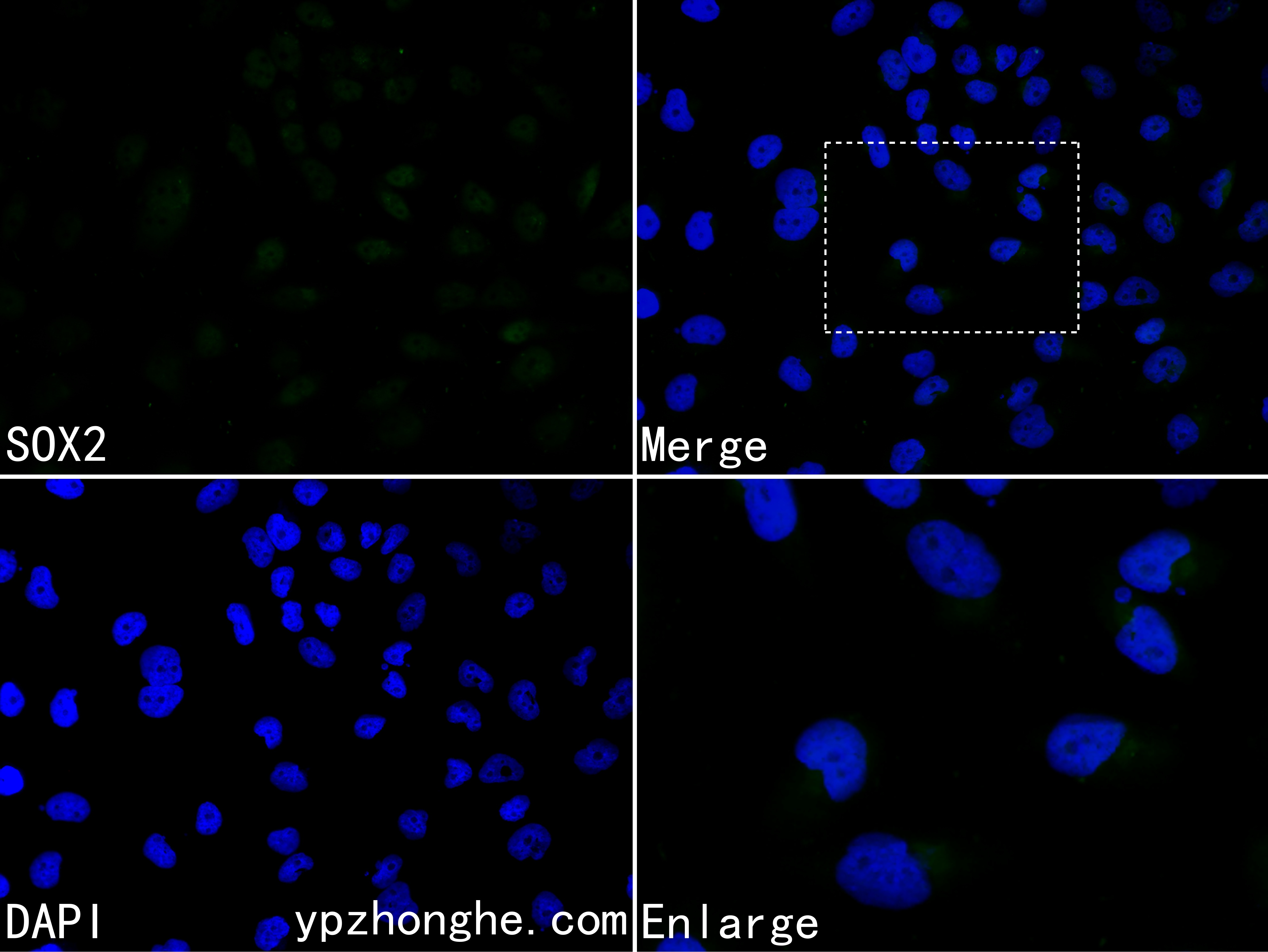 Recombinant SOX2 Rabbit Monoclonal Antibody - 一品众合官网
