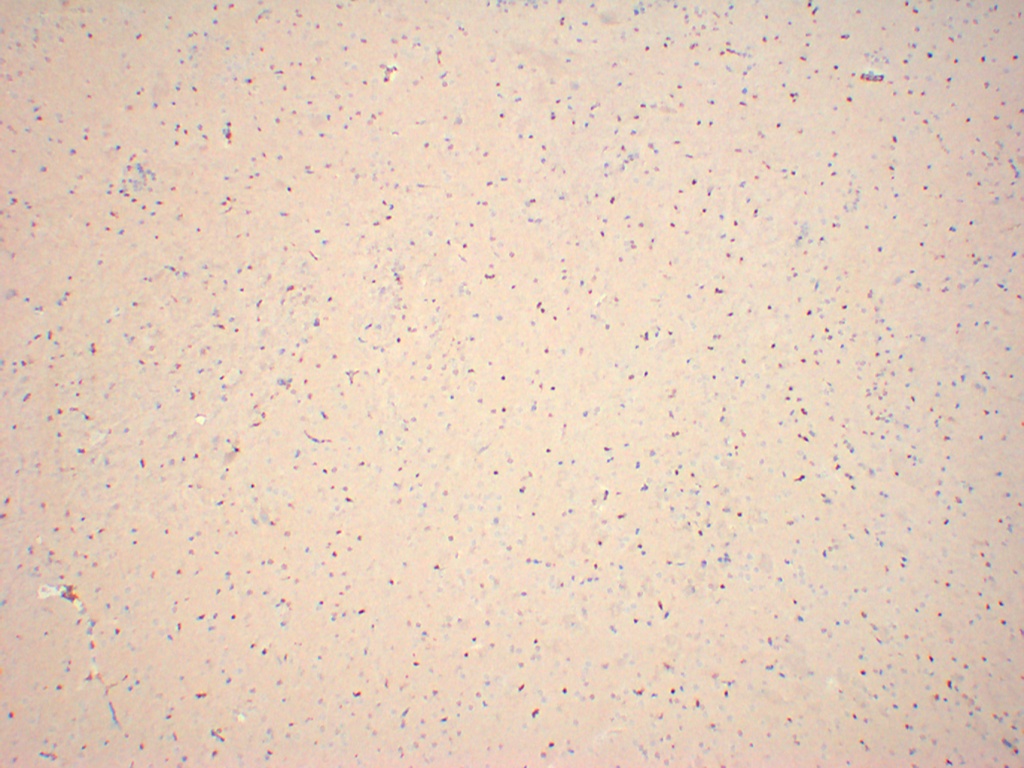 Recombinant SOX2 Rabbit Monoclonal Antibody - 一品众合官网