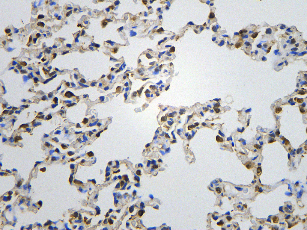 Recombinant CD86 Rabbit Monoclonal Antibody - 一品众合官网