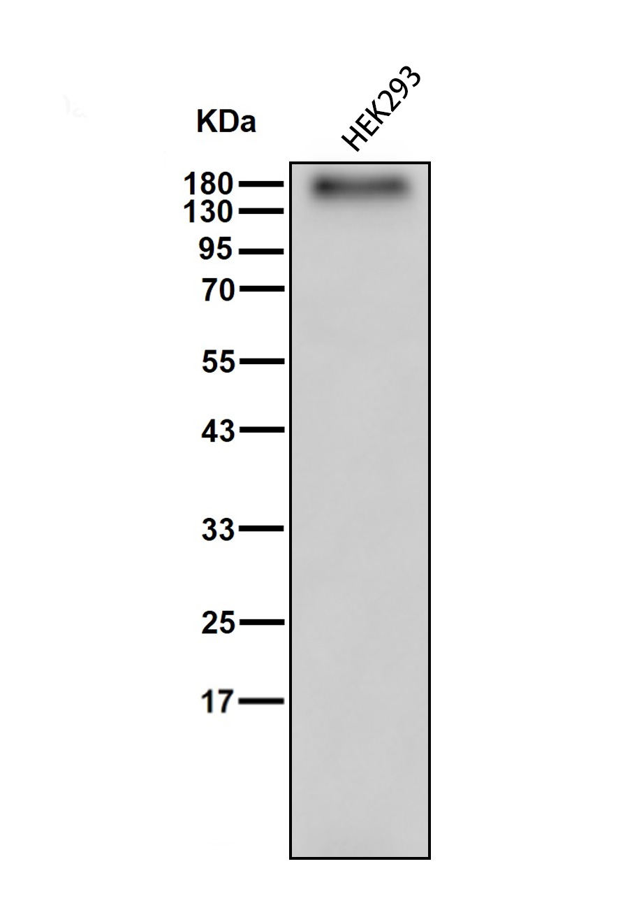 Recombinant Insulin receptor substrate 2 Rabbit Monoclonal Antibody ...