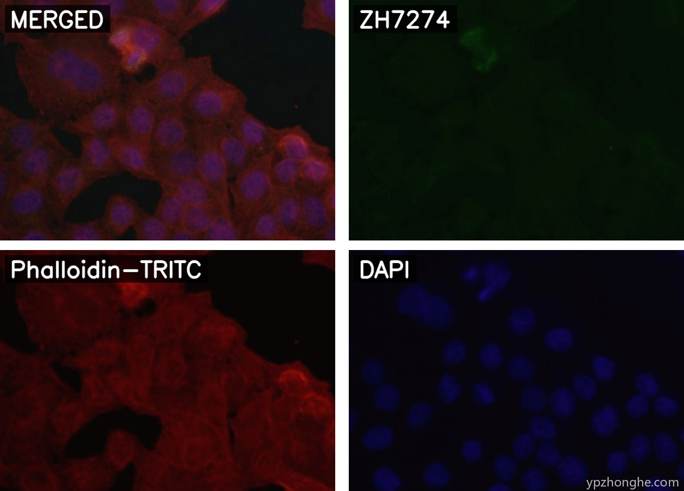 Recombinant p-STAT3 (S727) Rabbit Monoclonal Antibody - 一品众合官网