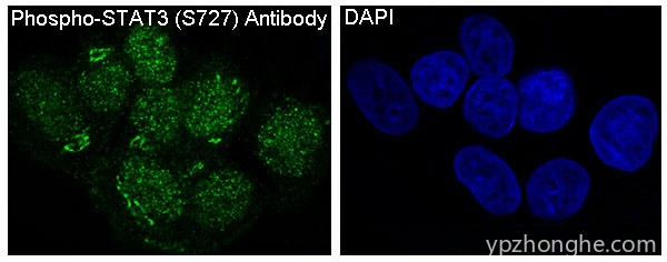 Recombinant p-STAT3 (S727) Rabbit Monoclonal Antibody - 一品众合官网