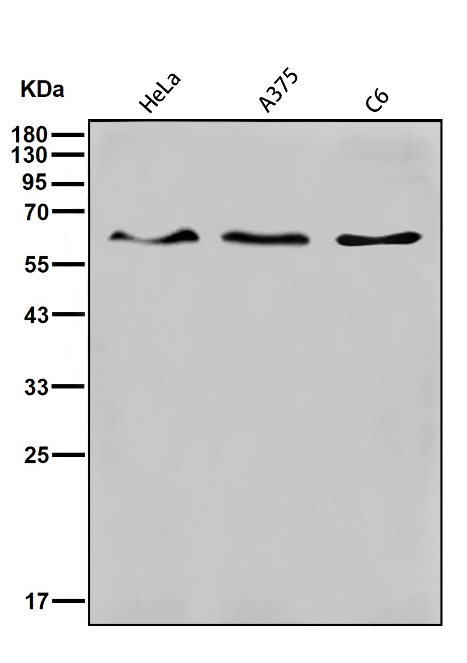 Recombinant Estrogen receptor Rabbit Monoclonal Antibody - 一品众合官网