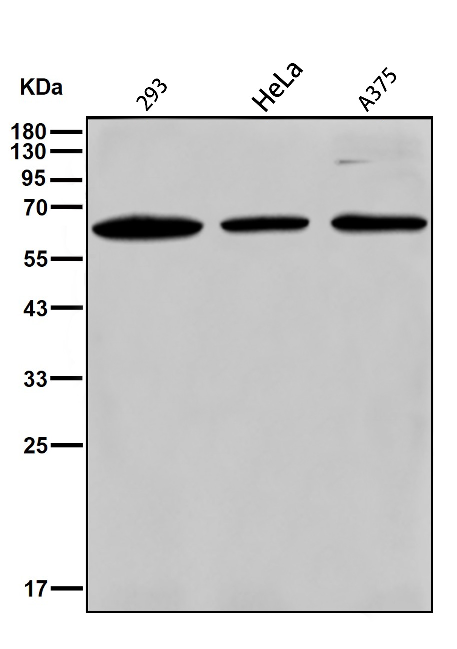 Recombinant NF-kB p65 Rabbit Monoclonal Antibody - 一品众合官网