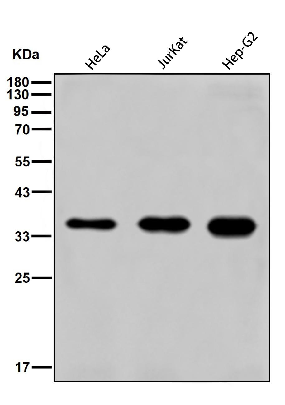 Recombinant IkB alpha Rabbit Monoclonal Antibody - 一品众合官网