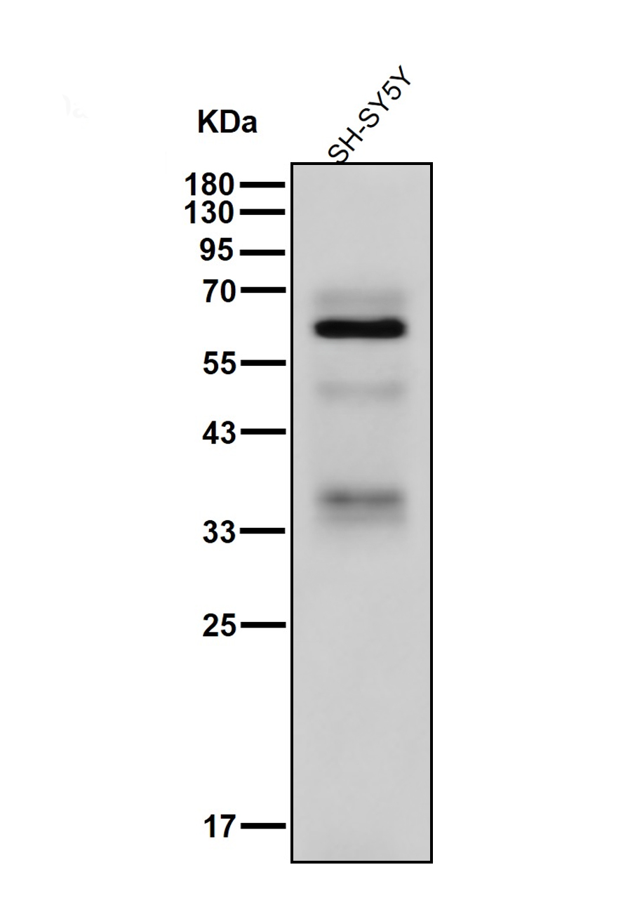 PINK1 Rabbit Polyclonal antibody - 一品众合官网
