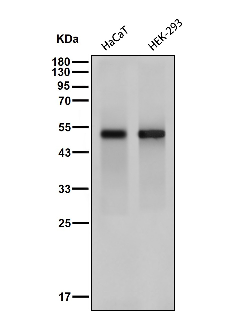 P53 Mouse Monoclonal antibody - 一品众合官网
